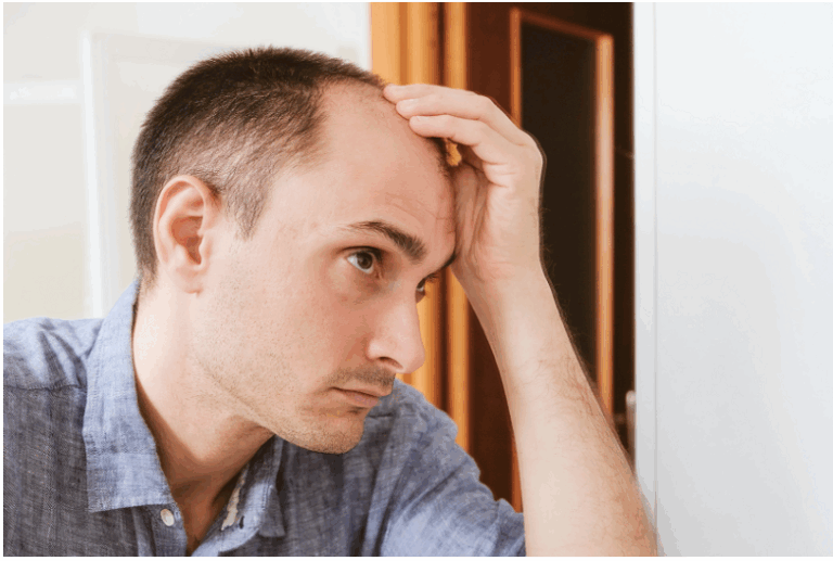 Hair Surgery 101: Is This the Miracle Fix for Your Receding Hairline?